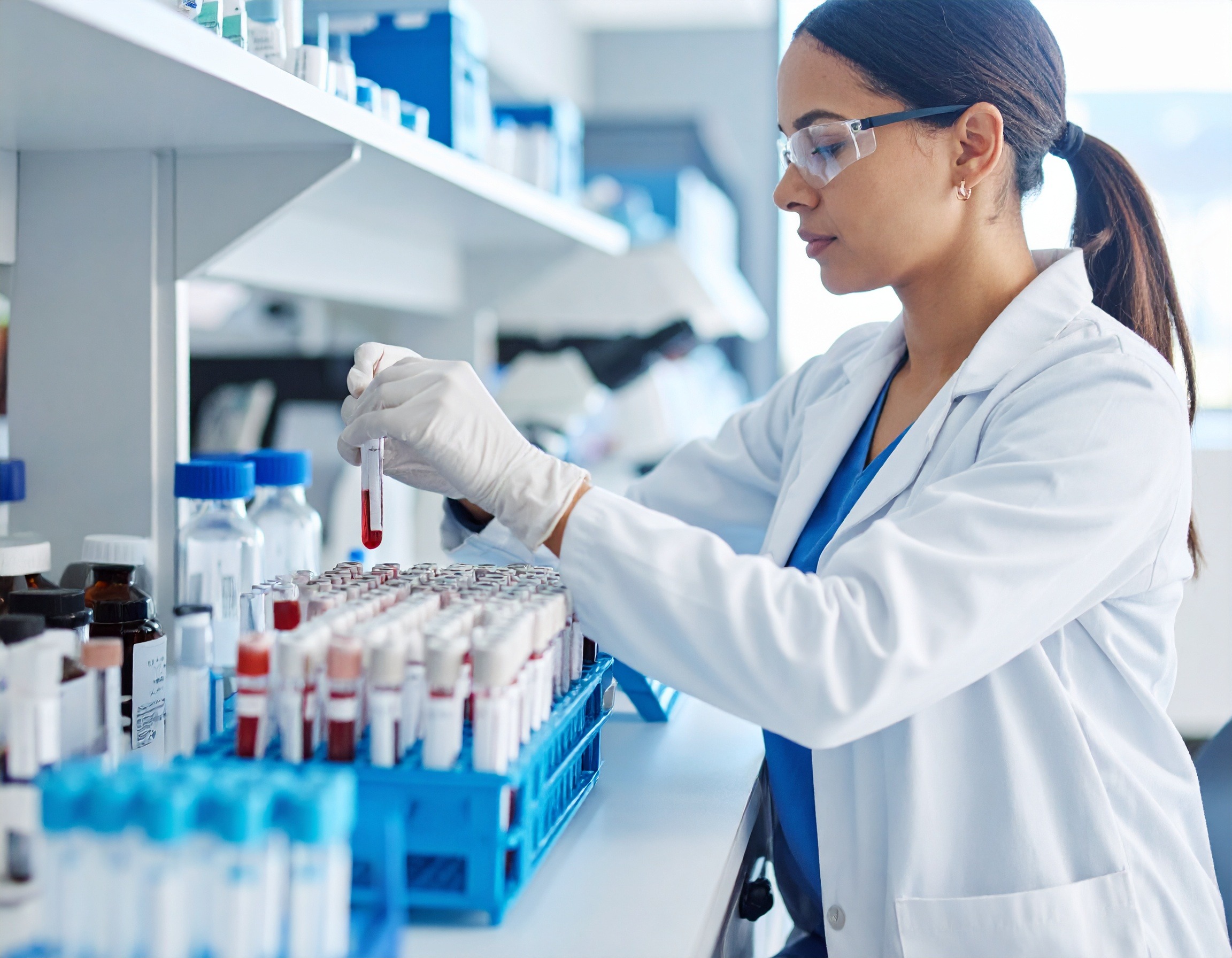 Influence of sampling methods on hemolysis - Macopharma